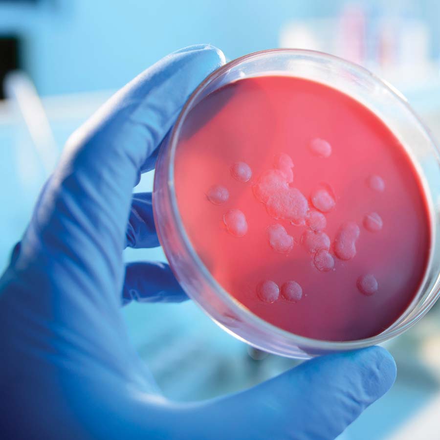 Antimicrobial Resistance, And Lack Of New Drugs, Raises Risk Of A ...